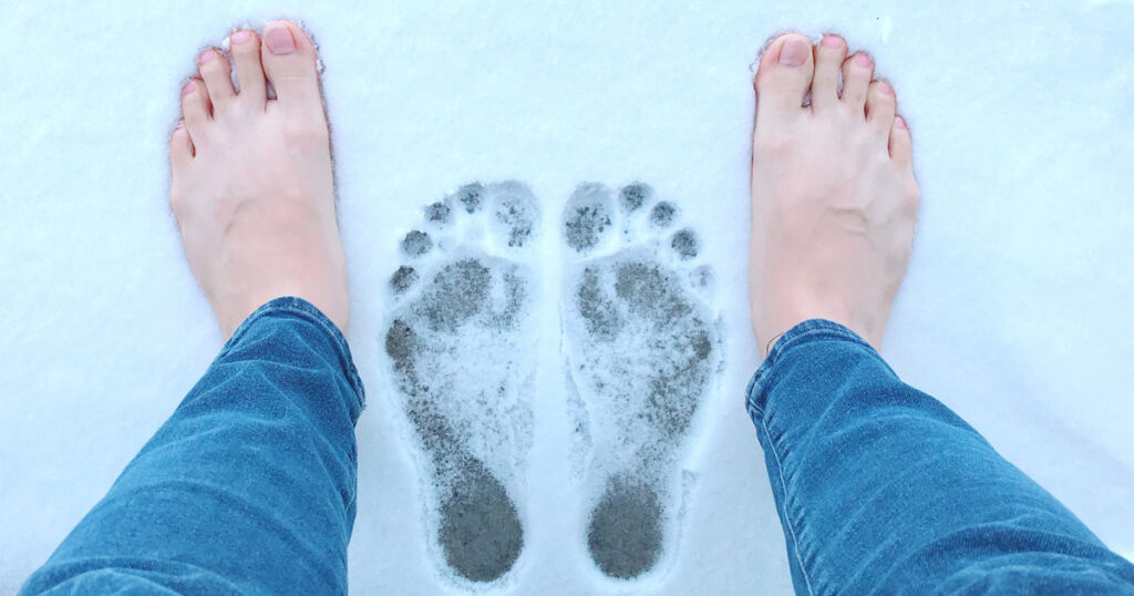 Red, itchy toes? Could it be chilblains? Maidenhead Podiatry ...